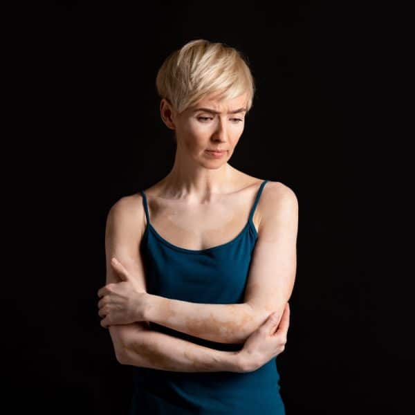 YOUR SURVIVAL GUIDE TO AUTOIMMUNE FLARES: WHAT YOU NEED TO KNOW